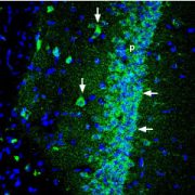Synaptic markers for pre- and postsynaptic regions | Alomone Labs