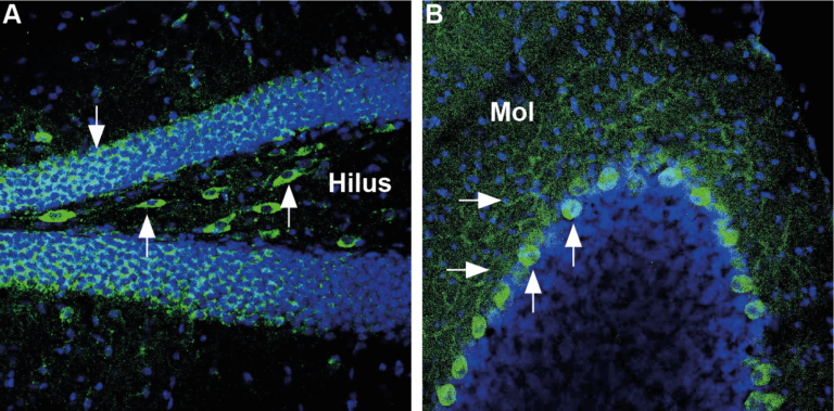 Immunohistochemistry (IHC) Protocols for Frozen Sections: Indirect ...