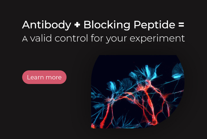 Membrane Protein Reagents, Antibodies, Toxins | Alomone Labs