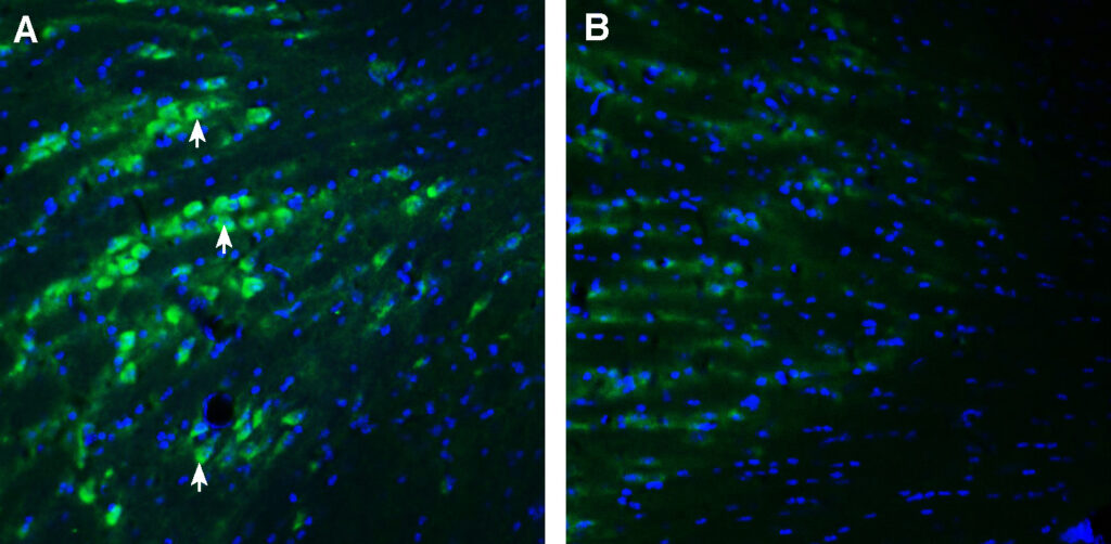Proton-Activated Chloride Channel 1 and Lyso-PS Receptors | Alomone Labs