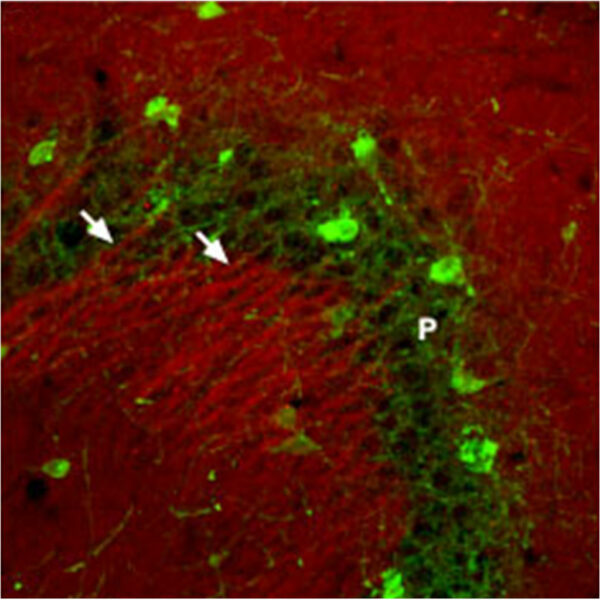 Voltage-Gated Sodium Channel Modulators | Alomone Labs