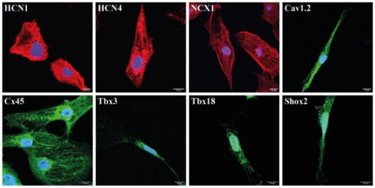 Making Better Cardiac Pacemaker Cells | Alomone Labs