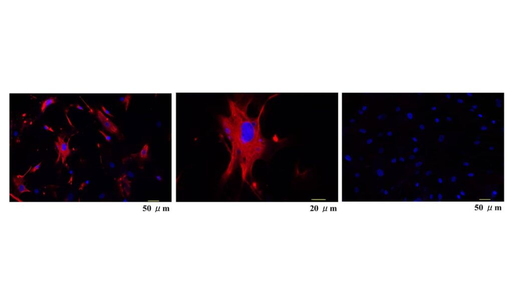 Choosing Immunoassay Controls | Alomone Labs